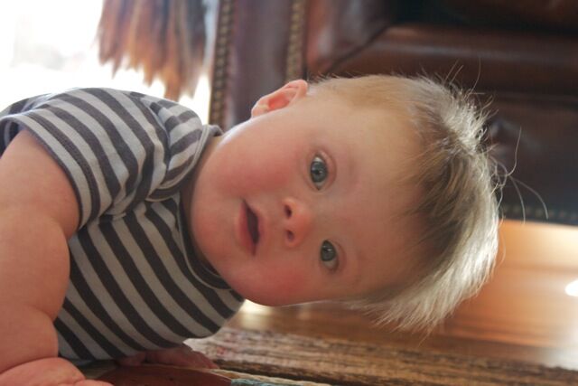 Infantile Spasm Video, A Prognosis, And What Symptoms Your Doctor Is ...