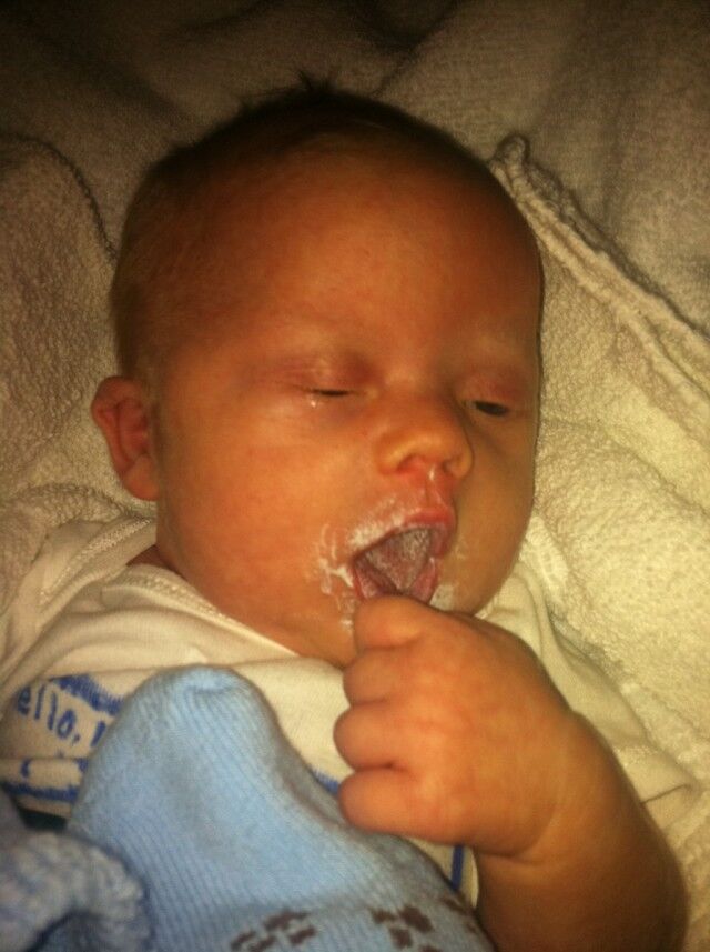 How A Barium Swallow Study Helps Determine If Your Baby With Down ...